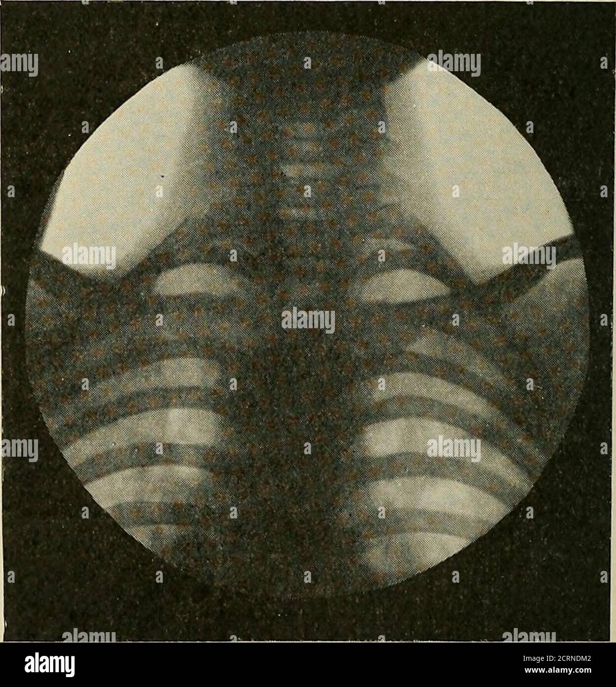 . Radiography and radio-therapeutics . Fig 183.—Normal cervical and ...