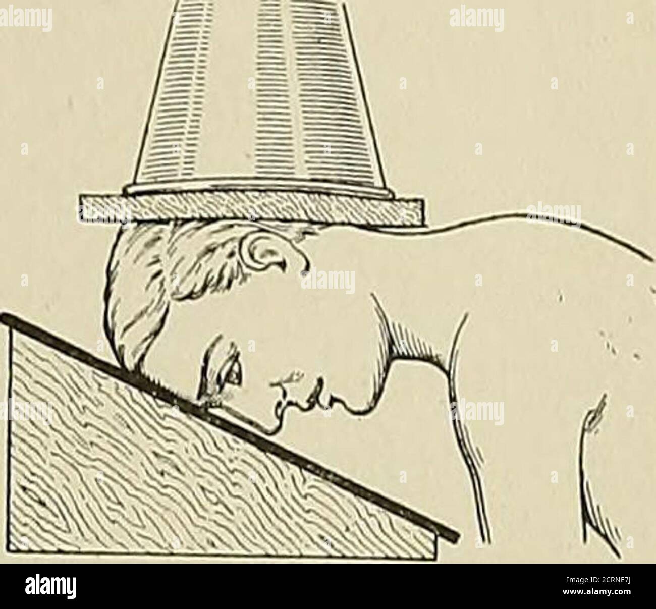 . Radiography and radio-therapeutics . PLATE XV.—Normal Skdlls. a ...