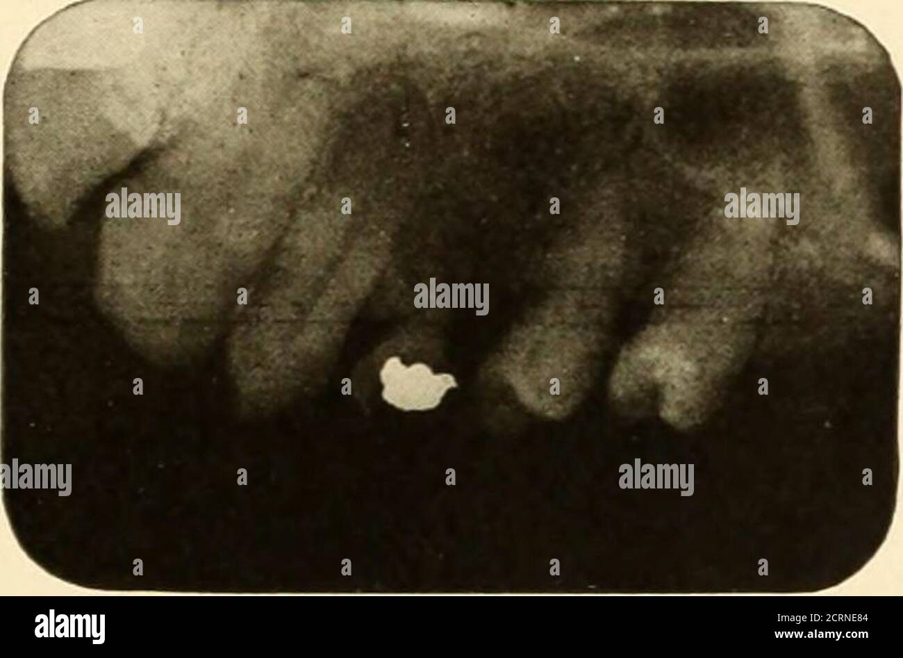 W c roentgen hi-res stock photography and images - Alamy
