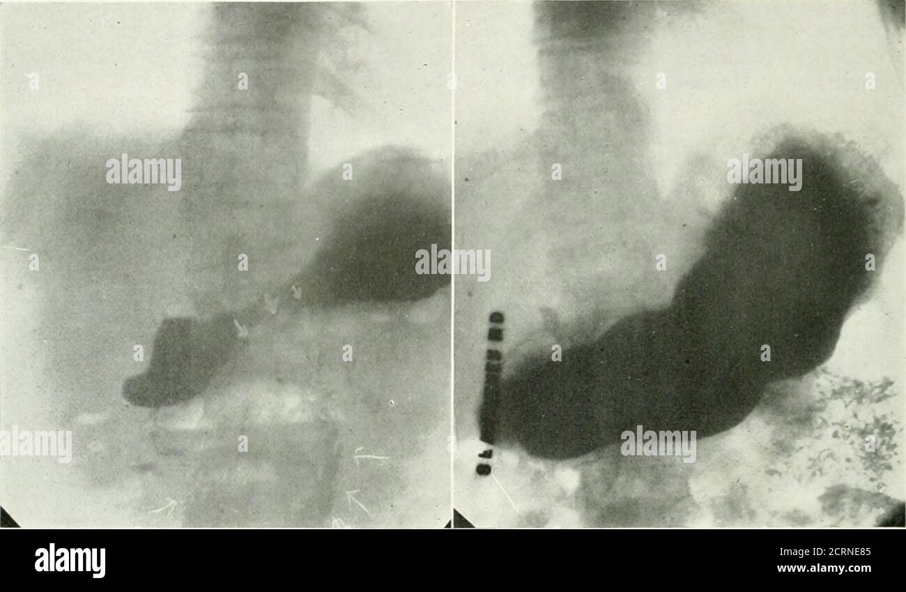 . The American journal of roentgenology, radium therapy and nuclear ...