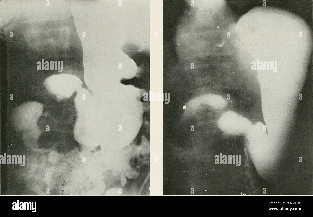 . The American journal of roentgenology, radium therapy and nuclear ...