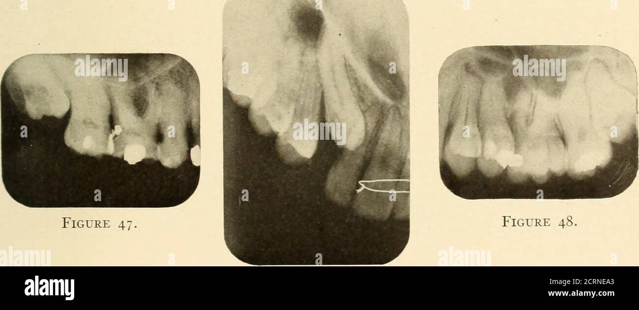 Oral Roentgenology : a Roentgen study of the anatomy and pathology of ...