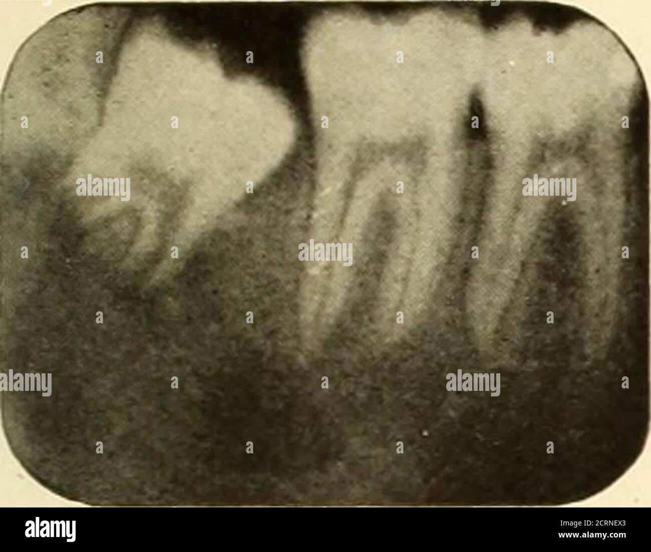 Oral Roentgenology : a Roentgen study of the anatomy and pathology of ...