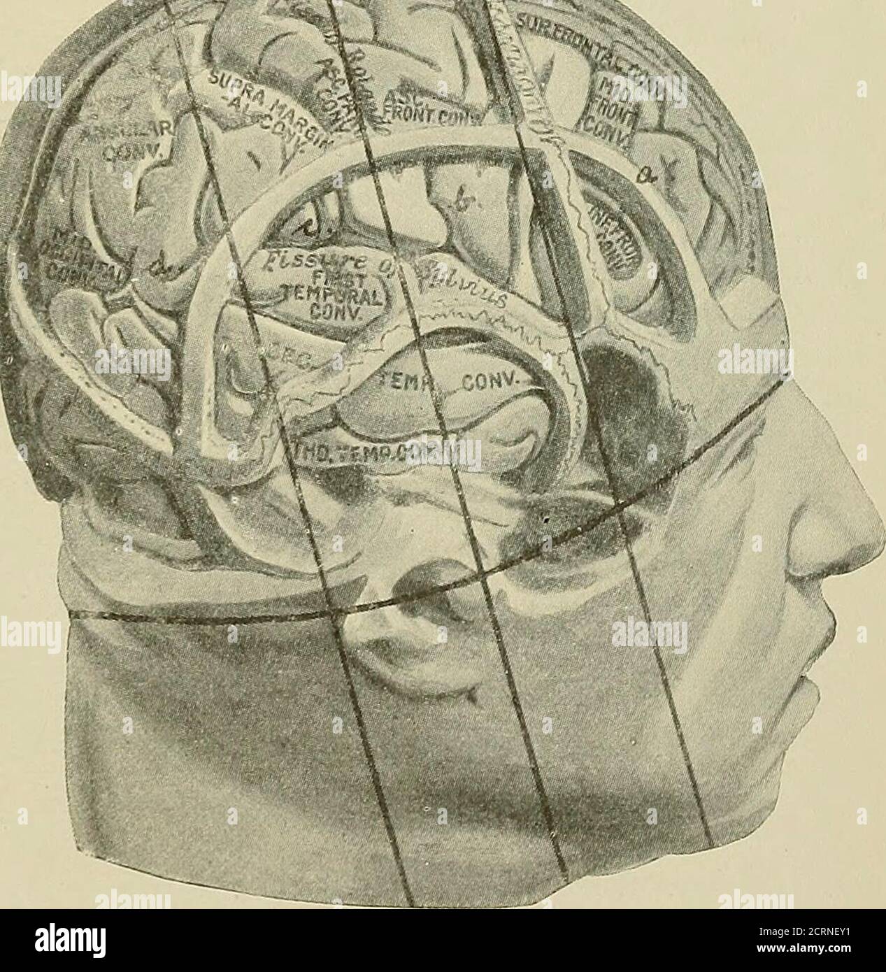 Sagittal suture hi-res stock photography and images - Alamy