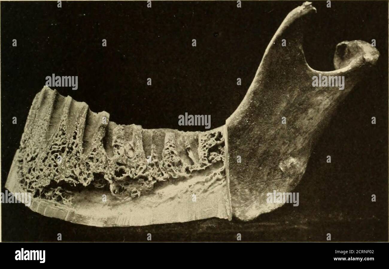 Oral Roentgenology : a Roentgen study of the anatomy and pathology of ...
