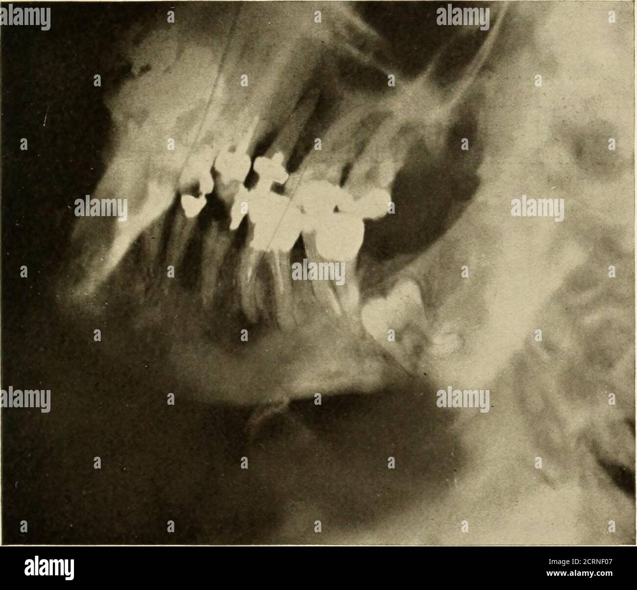 Oral Roentgenology : a Roentgen study of the anatomy and pathology of ...