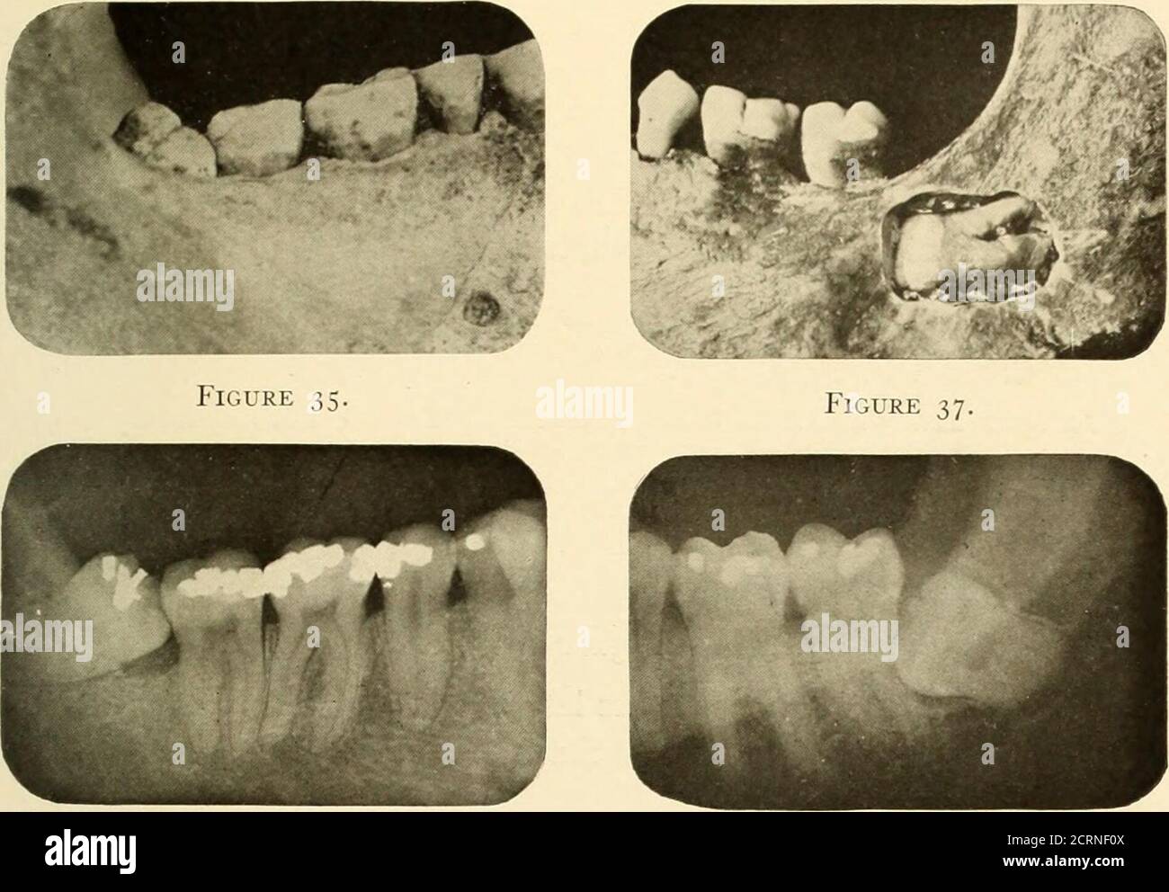 Oral Roentgenology : a Roentgen study of the anatomy and pathology of ...