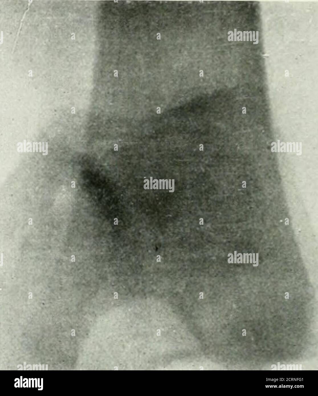 . The American journal of roentgenology, radium therapy and nuclear ...