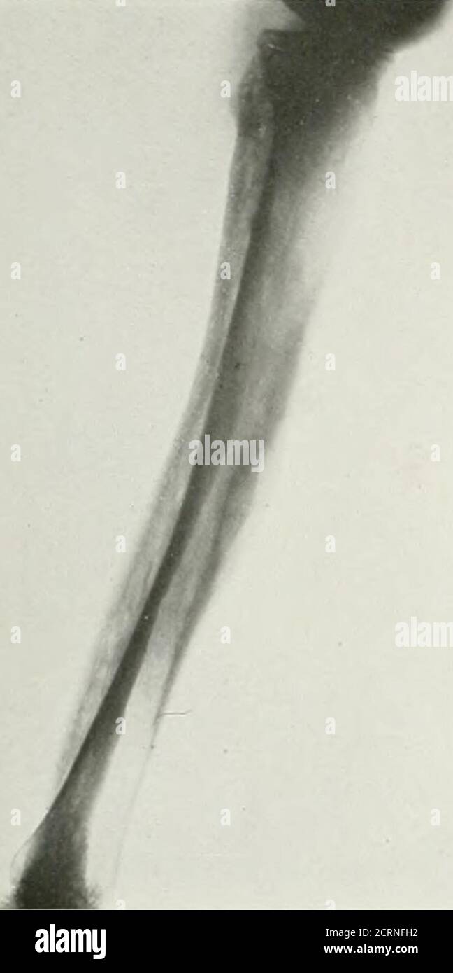 . The American journal of roentgenology, radium therapy and nuclear ...