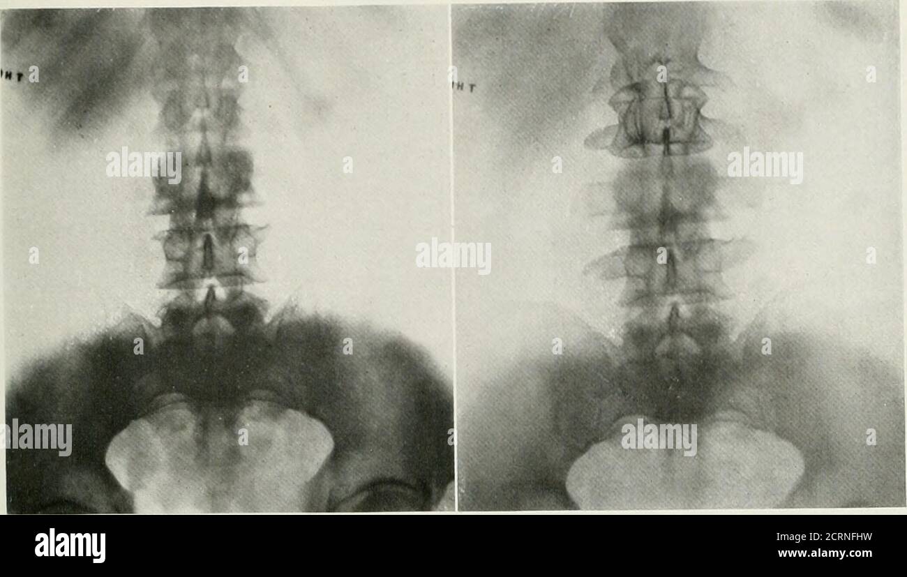 . The American journal of roentgenology, radium therapy and nuclear ...