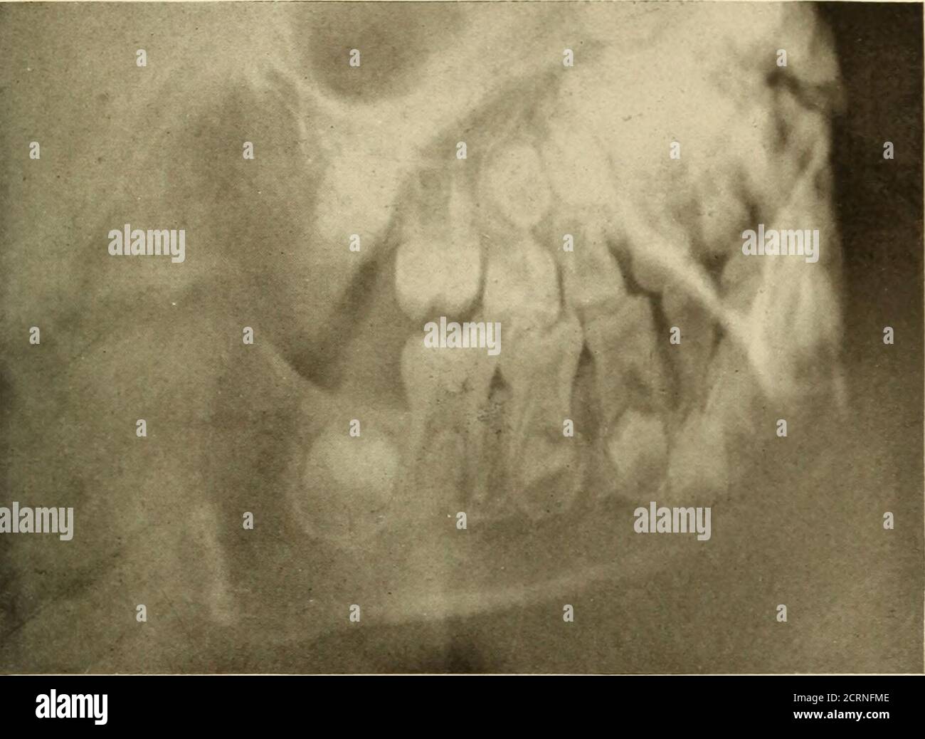 W c roentgen hi-res stock photography and images - Alamy