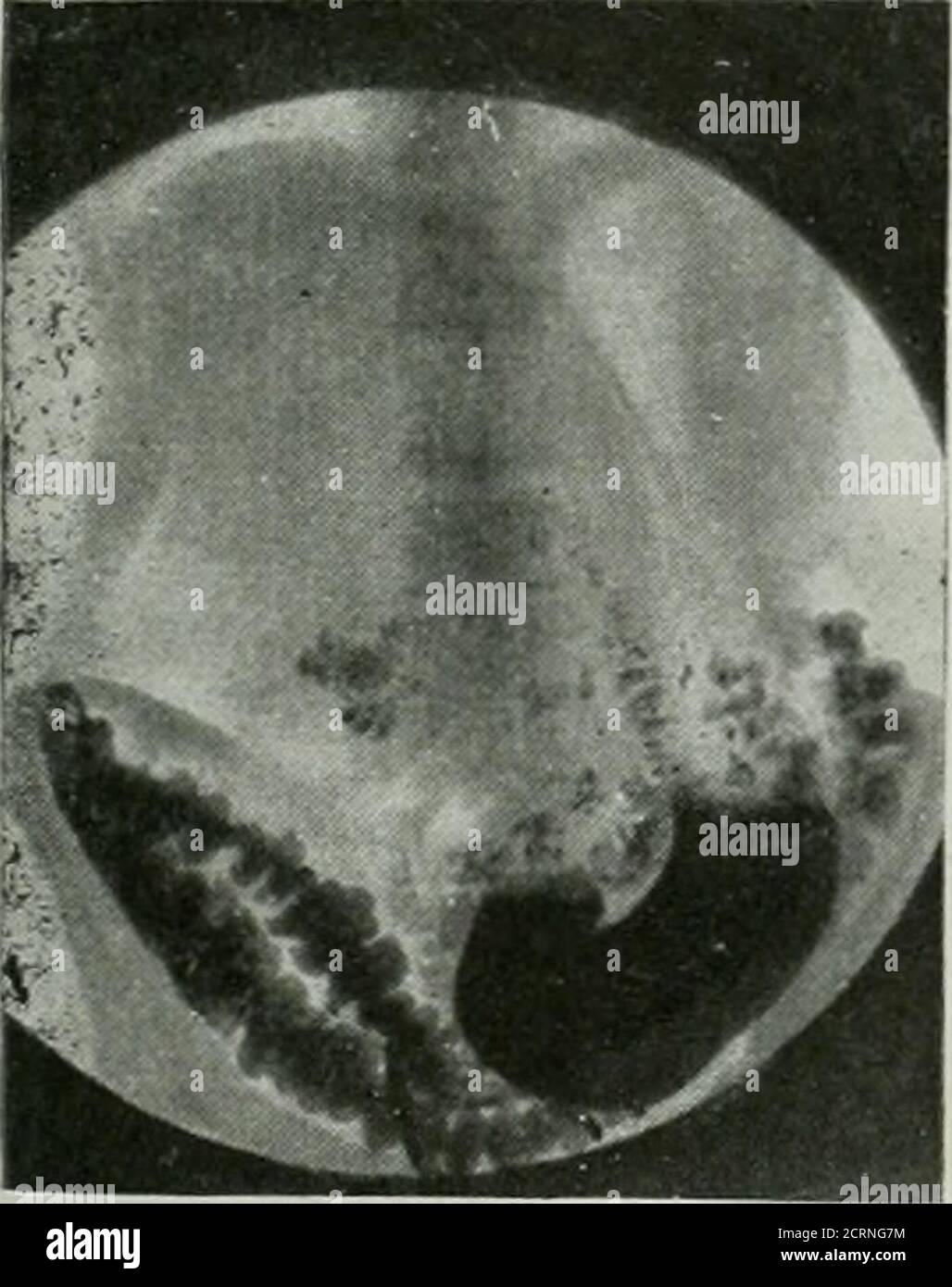 . The American journal of roentgenology, radium therapy and nuclear ...