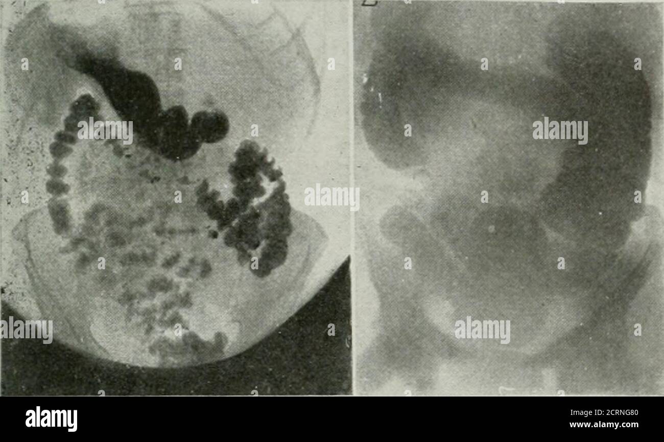. The American journal of roentgenology, radium therapy and nuclear ...