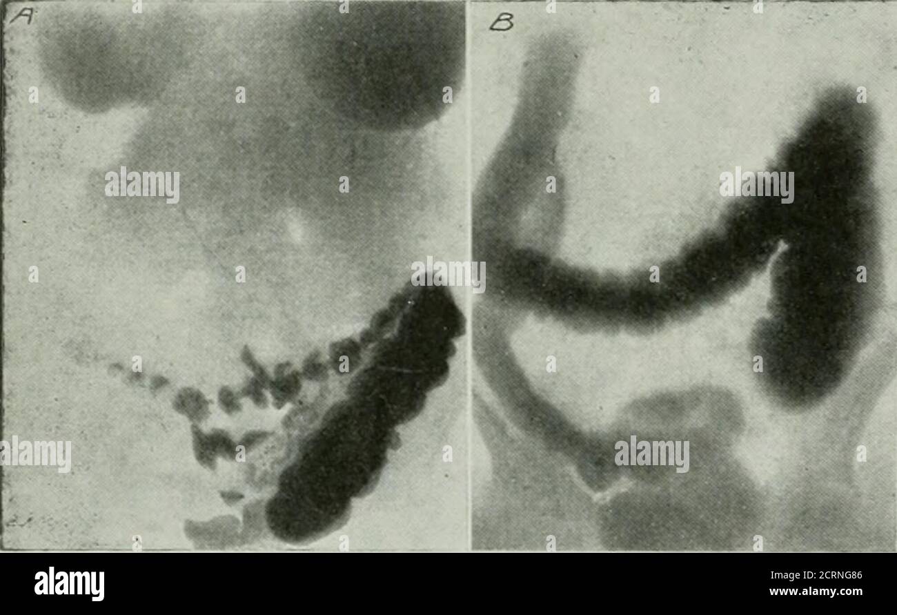 . The American journal of roentgenology, radium therapy and nuclear ...