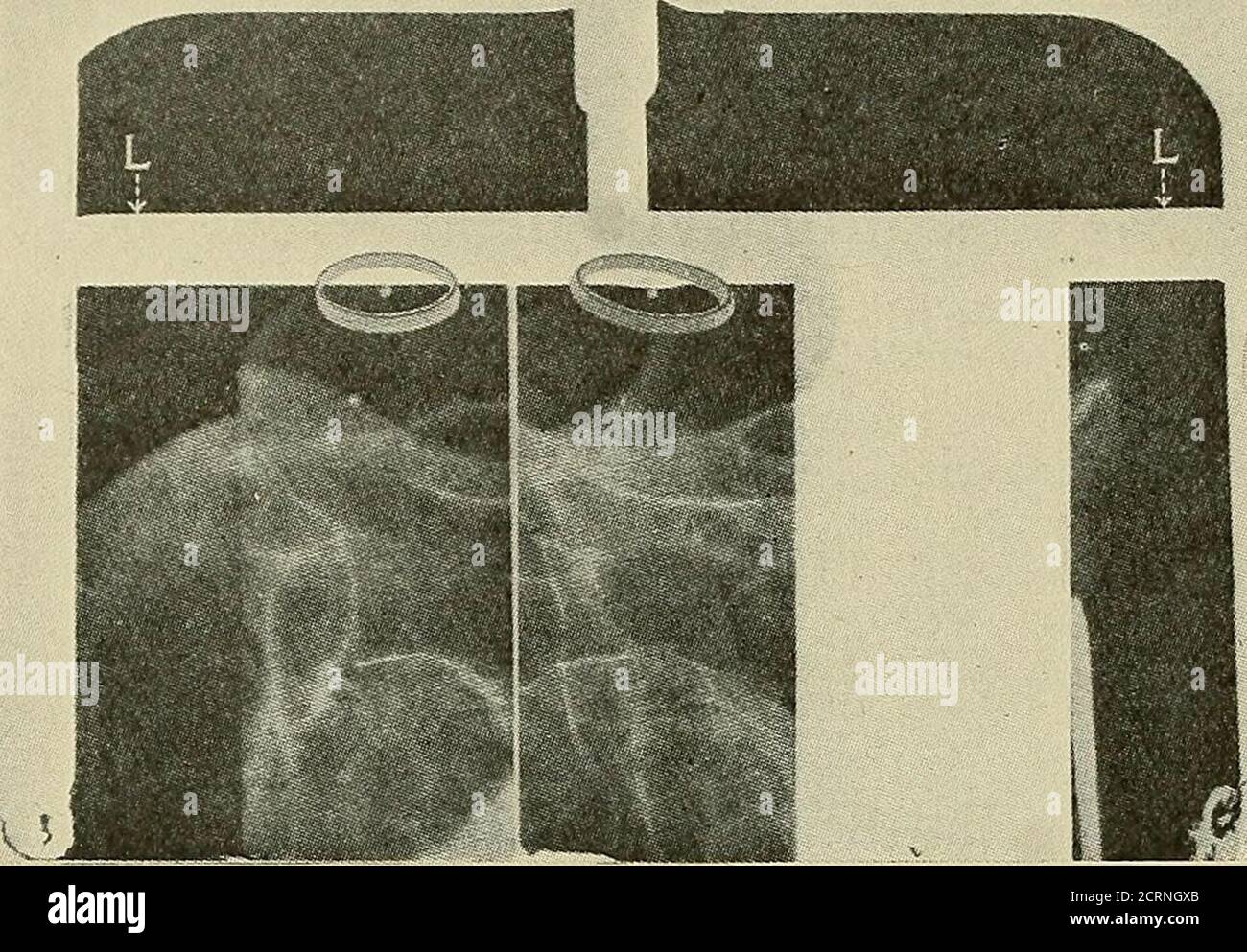 . Radiography and radio-therapeutics . ;P Via. 155.—Diagram of the ...