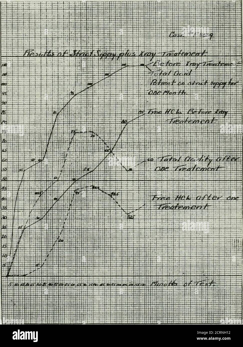 Rt therapy hi-res stock photography and images - Alamy