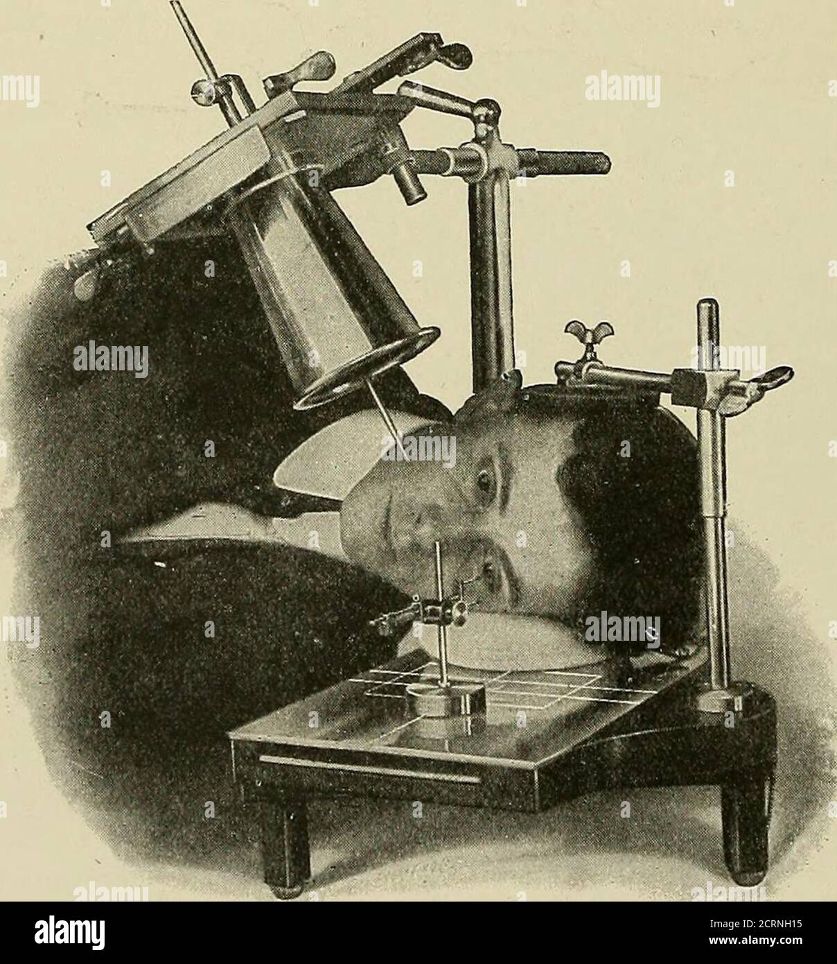 . Radiography and radio-therapeutics . FlGi 149.—Sweets eye localiser ...