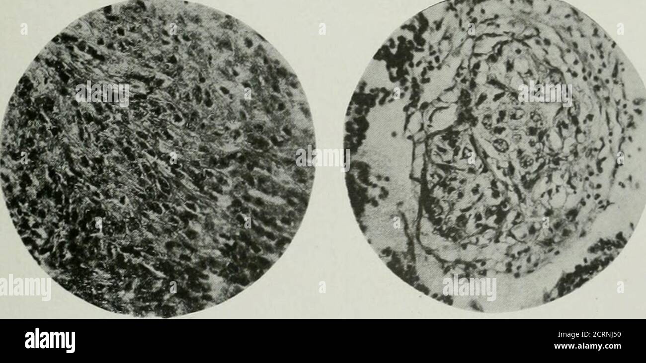 . The American journal of roentgenology, radium therapy and nuclear ...