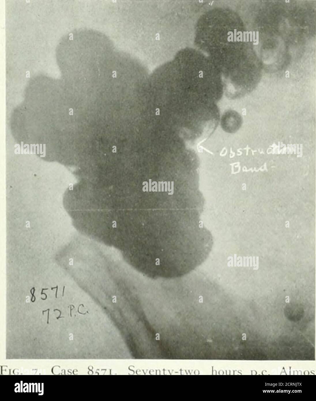 . The American journal of roentgenology, radium therapy and nuclear ...