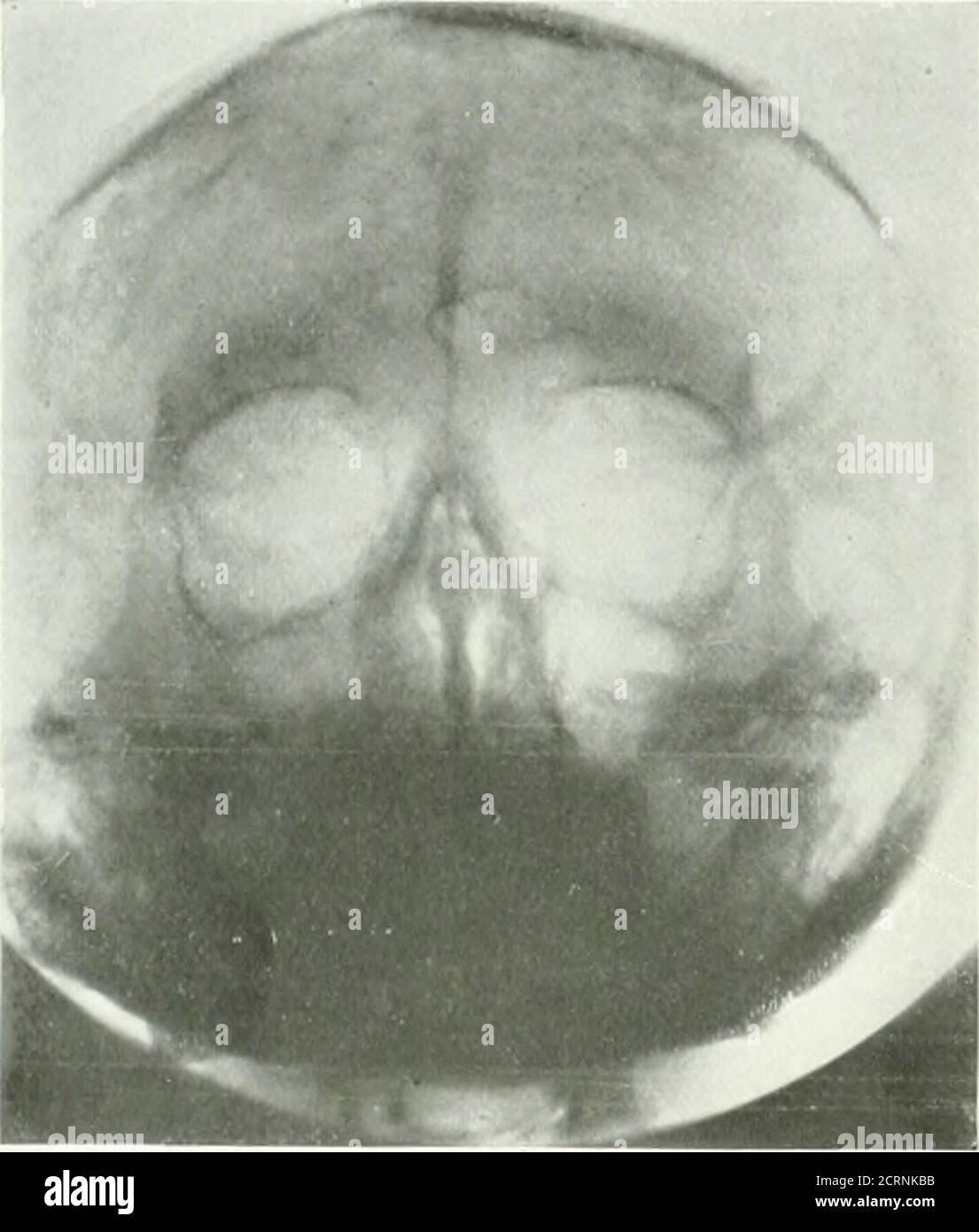 Symptoms improve hi-res stock photography and images - Alamy