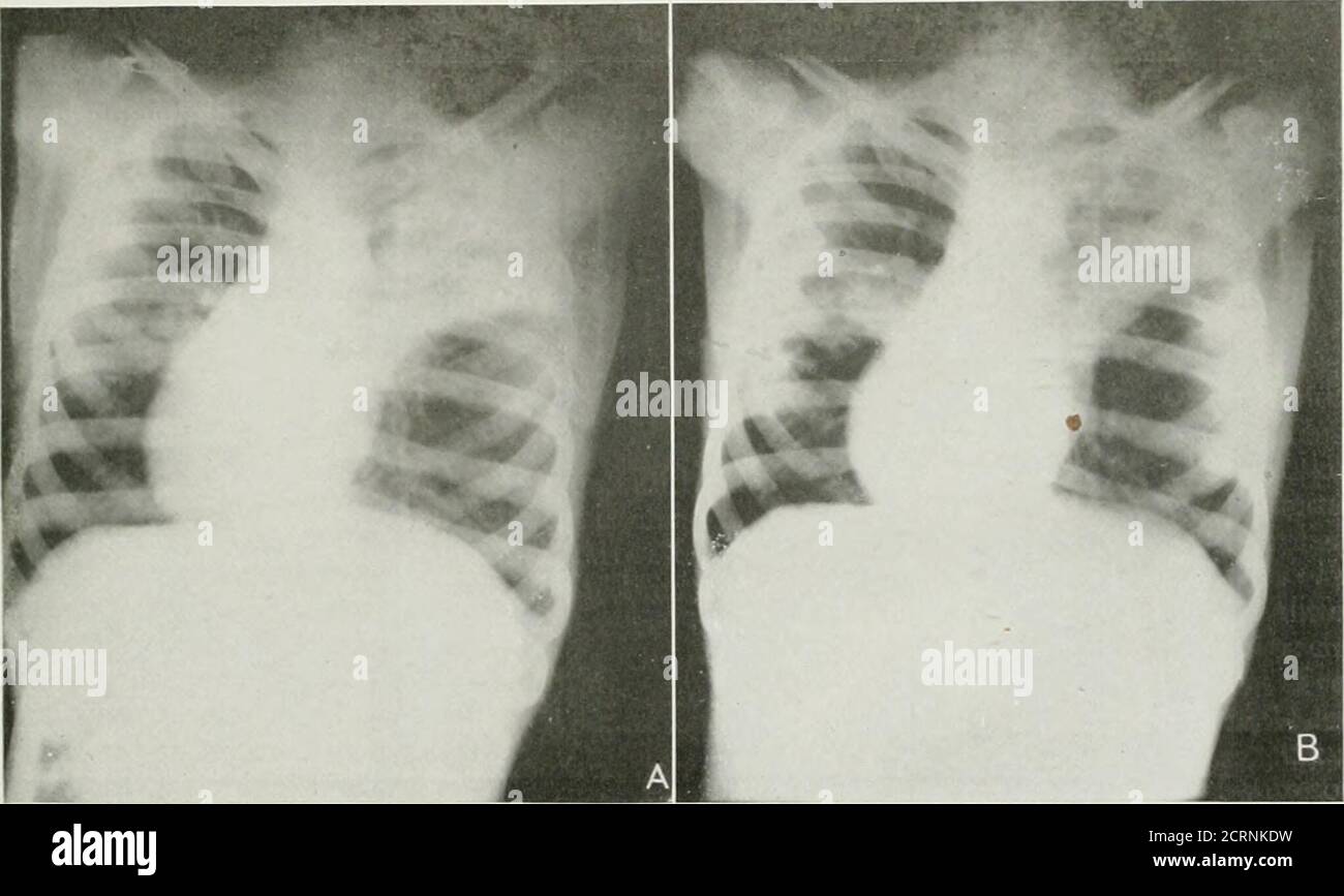 . The American journal of roentgenology, radium therapy and nuclear ...