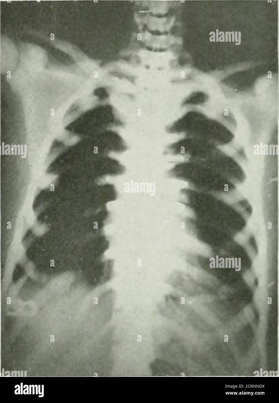 . The American journal of roentgenology, radium therapy and nuclear ...