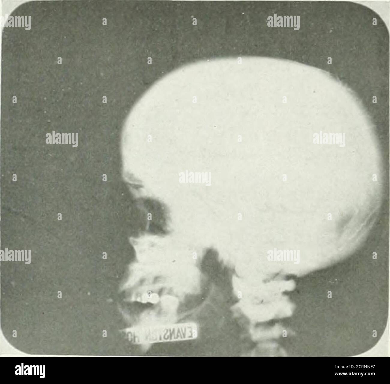 . The American journal of roentgenology, radium therapy and nuclear ...