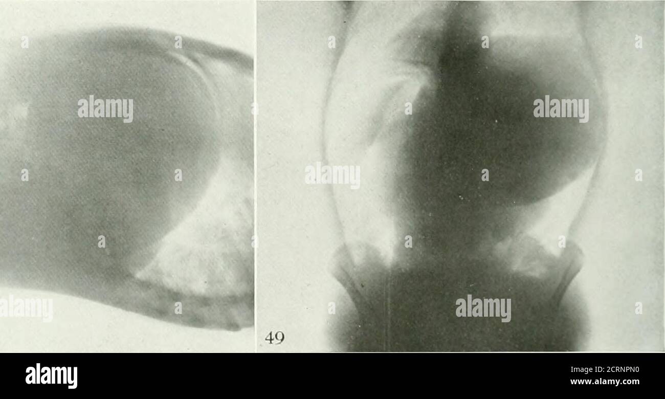 Liver lateral view hi-res stock photography and images - Alamy