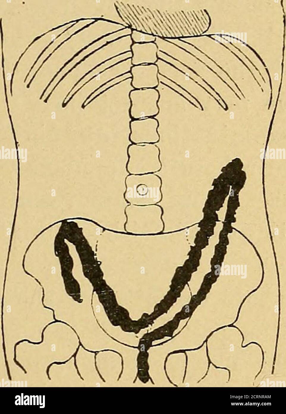 . A text-book of radiology . re of the digestive tube, andobstruction ...