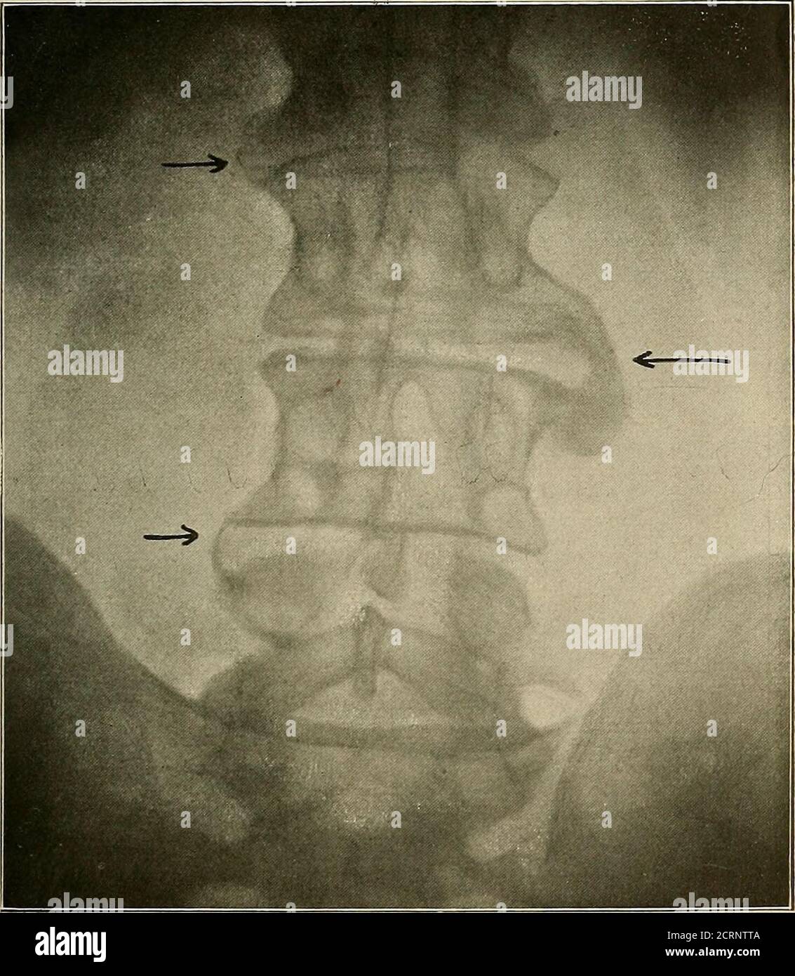False rib hi-res stock photography and images - Alamy