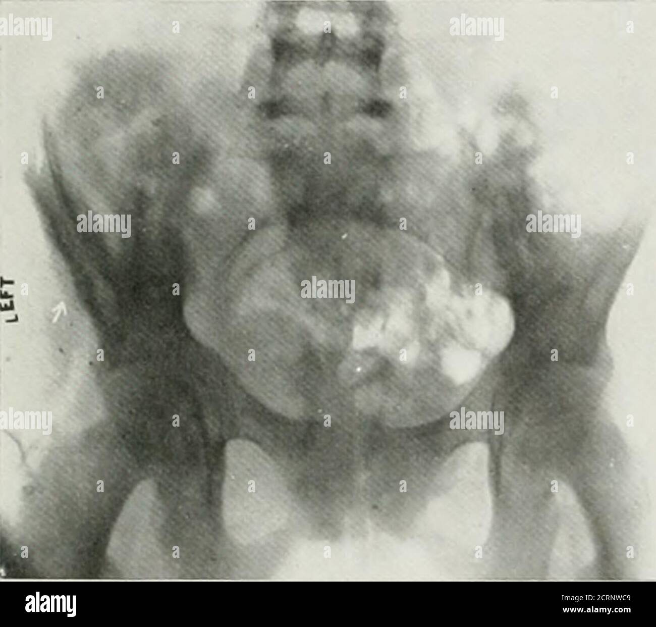 . The American journal of roentgenology, radium therapy and nuclear ...