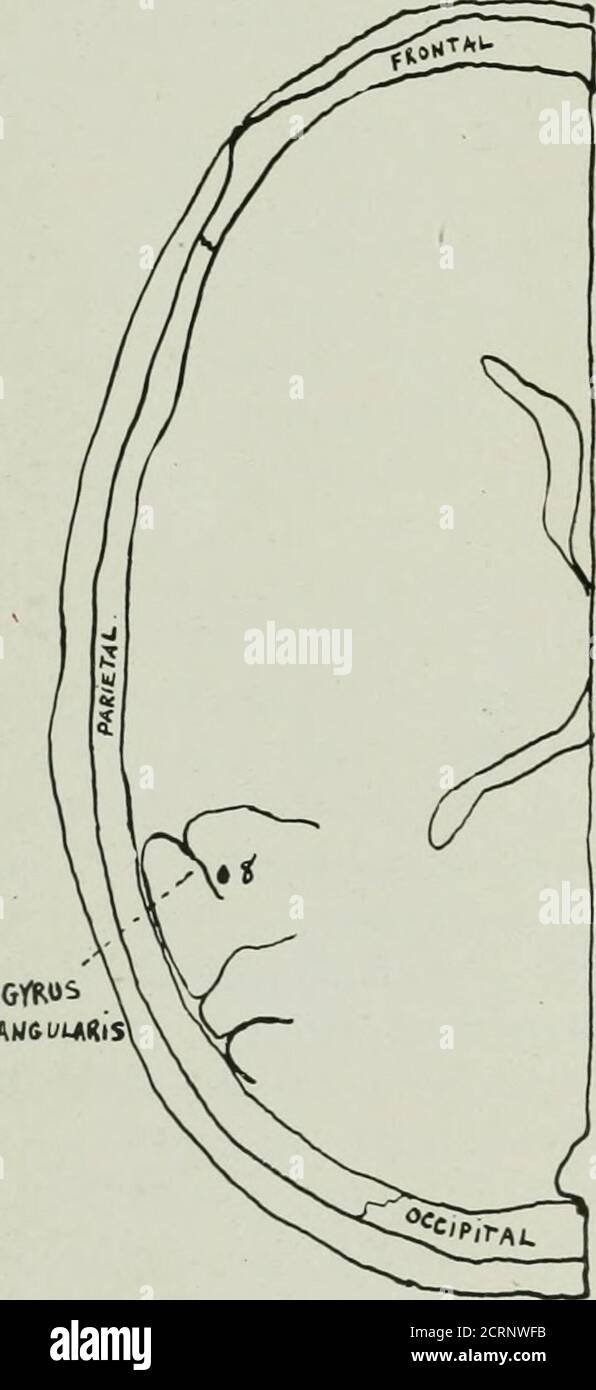 Squamous suture hi-res stock photography and images - Alamy