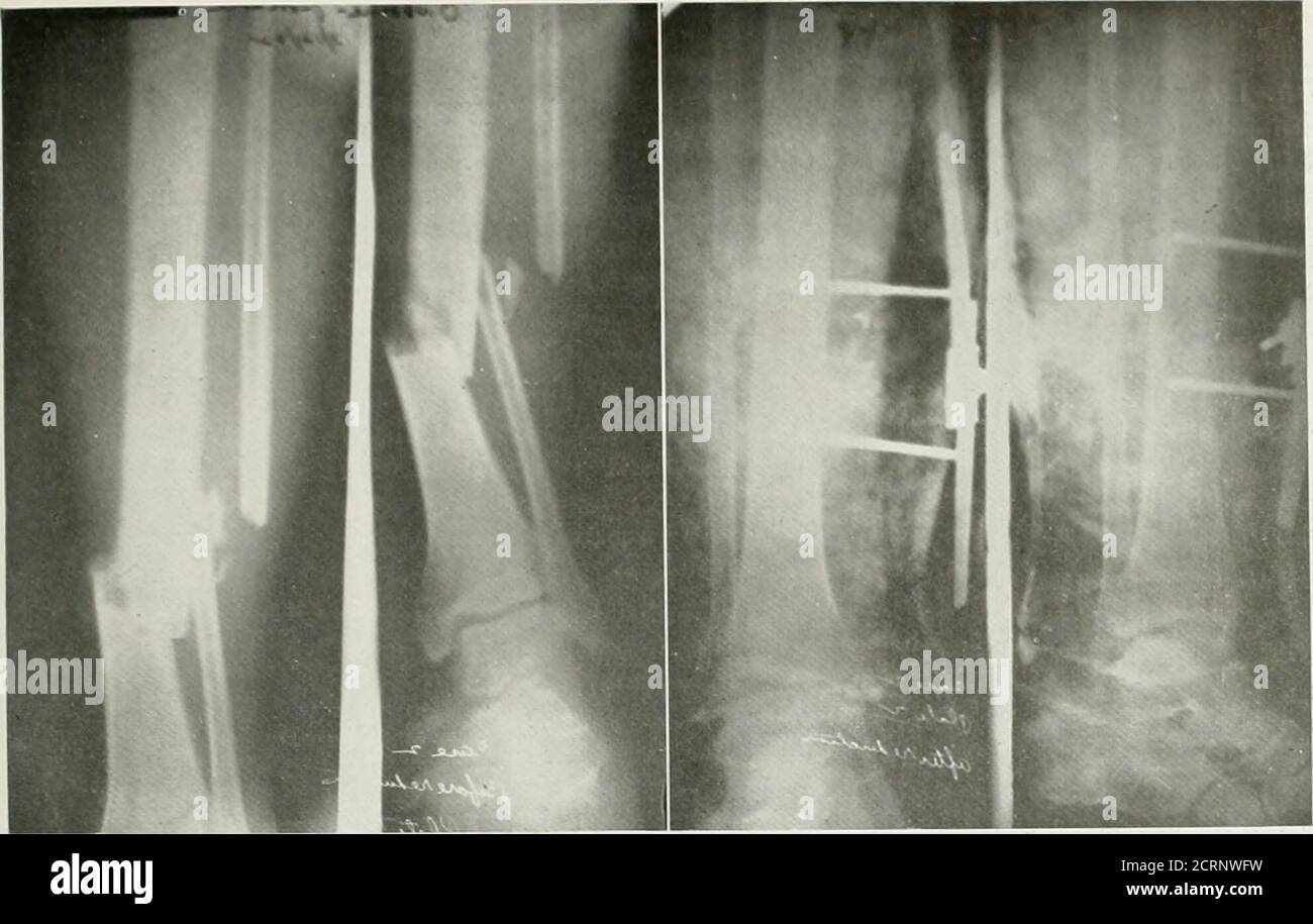 Oblique kick hi-res stock photography and images - Alamy