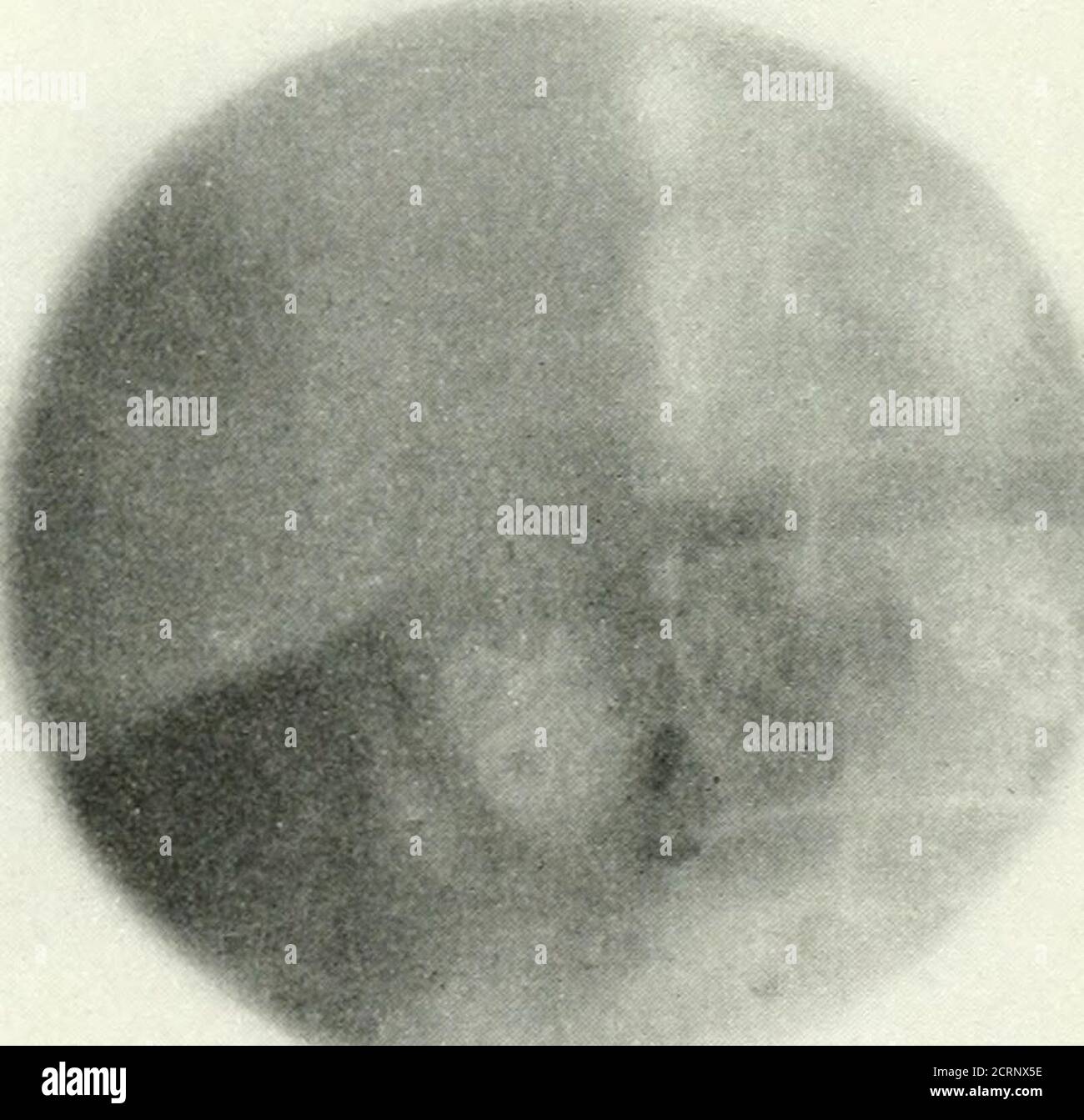 . Radiography, x-ray therapeutics and radium therapy . PLATE LI ...