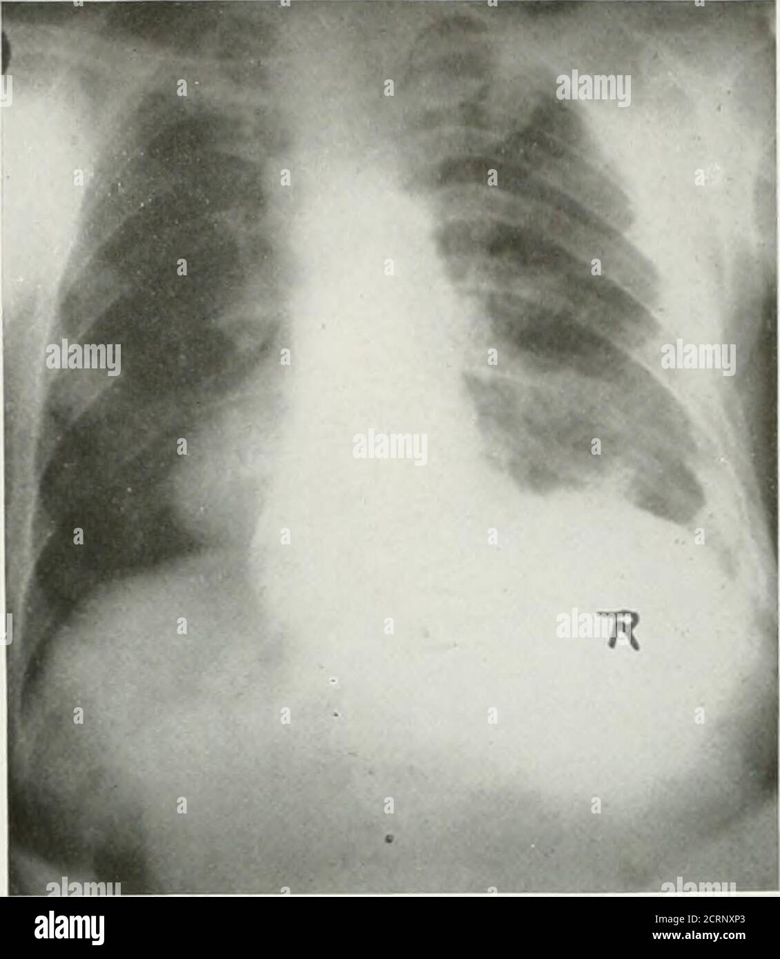 . The American journal of roentgenology, radium therapy and nuclear ...