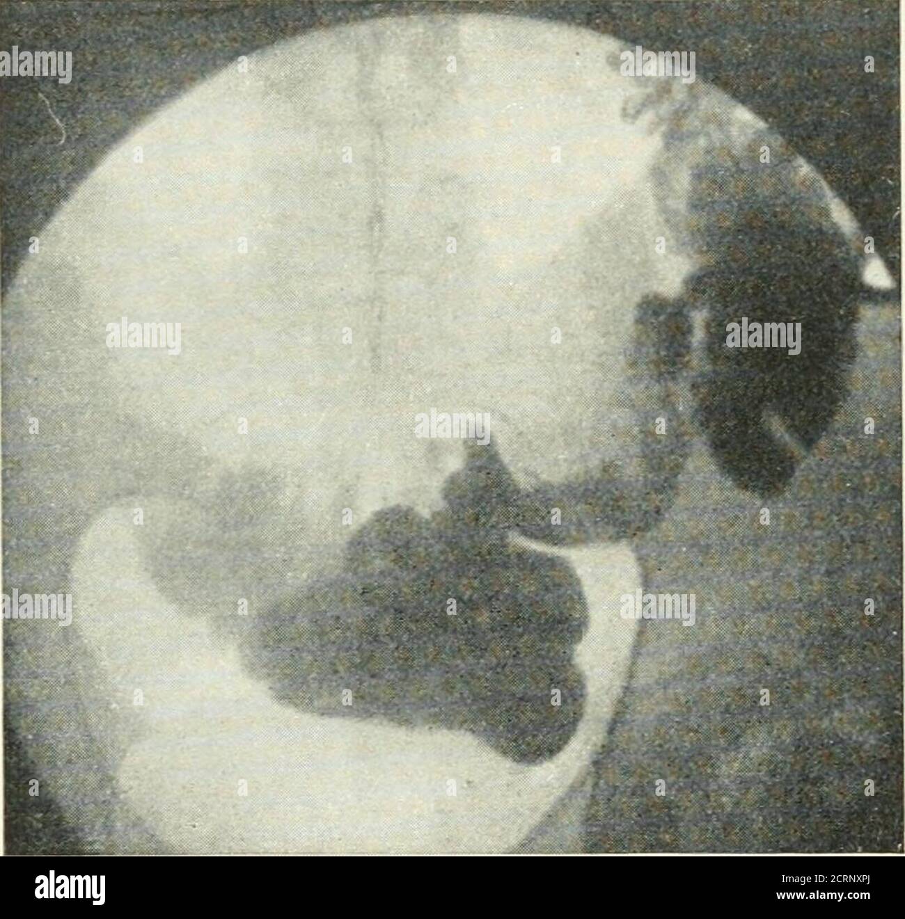 . Radiography, x-ray therapeutics and radium therapy . position while ...