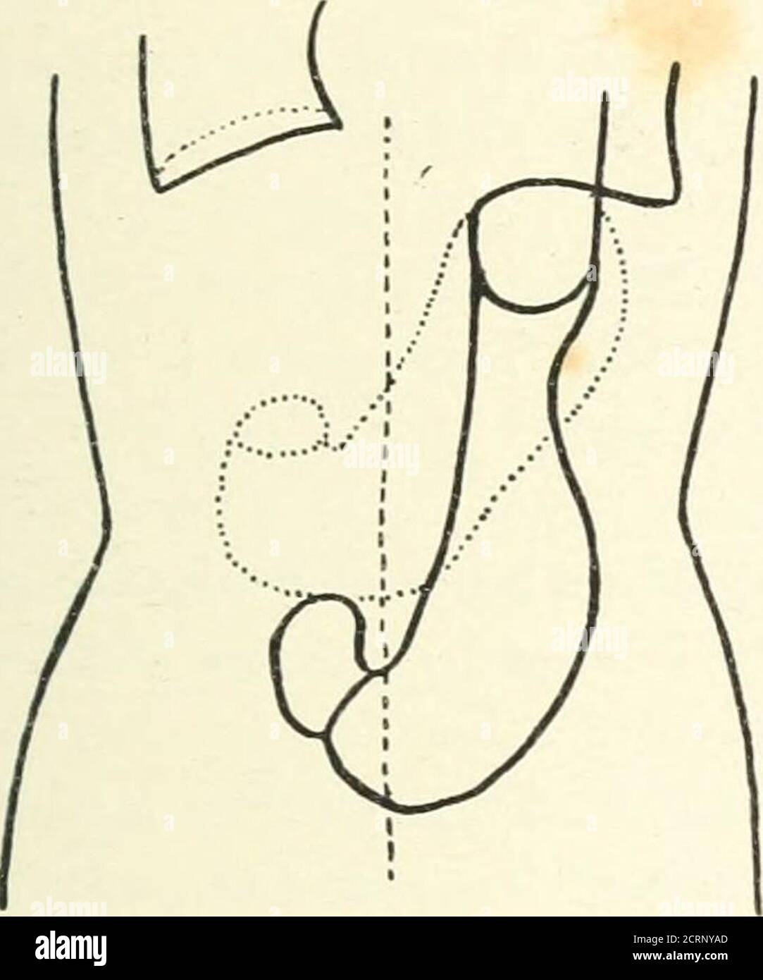 . Radiography, x-ray therapeutics and radium therapy . PLATE XLV ...