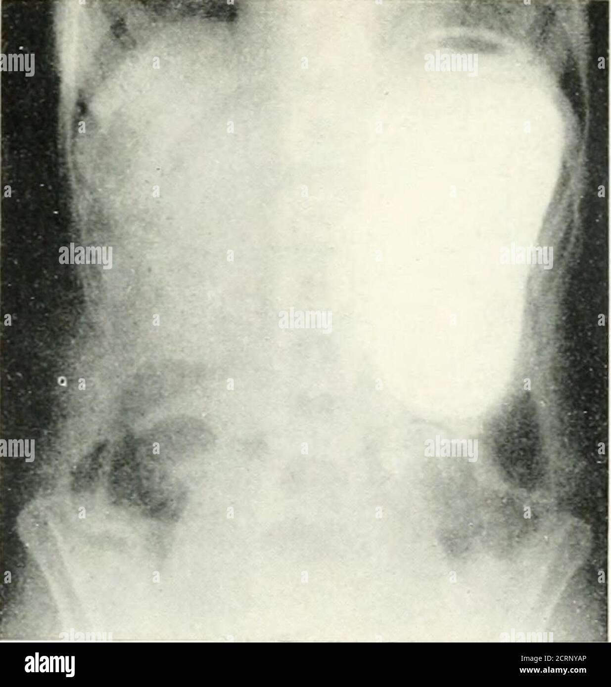 . Radiography, x-ray therapeutics and radium therapy Stock Photo - Alamy