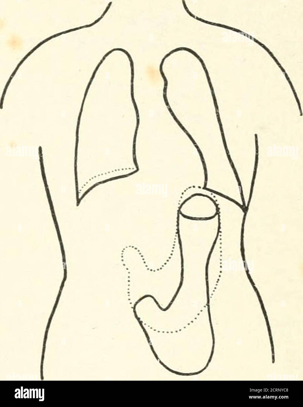 . Radiography, x-ray therapeutics and radium therapy . Fig. I68.-T0 ...