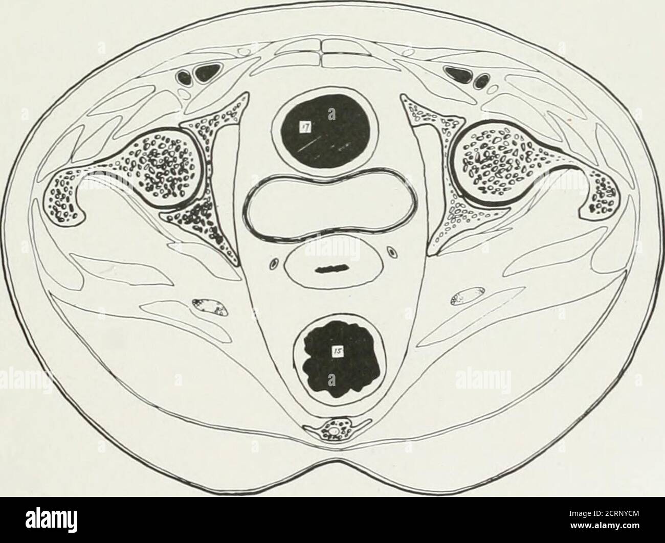 . The American journal of roentgenology, radium therapy and nuclear ...