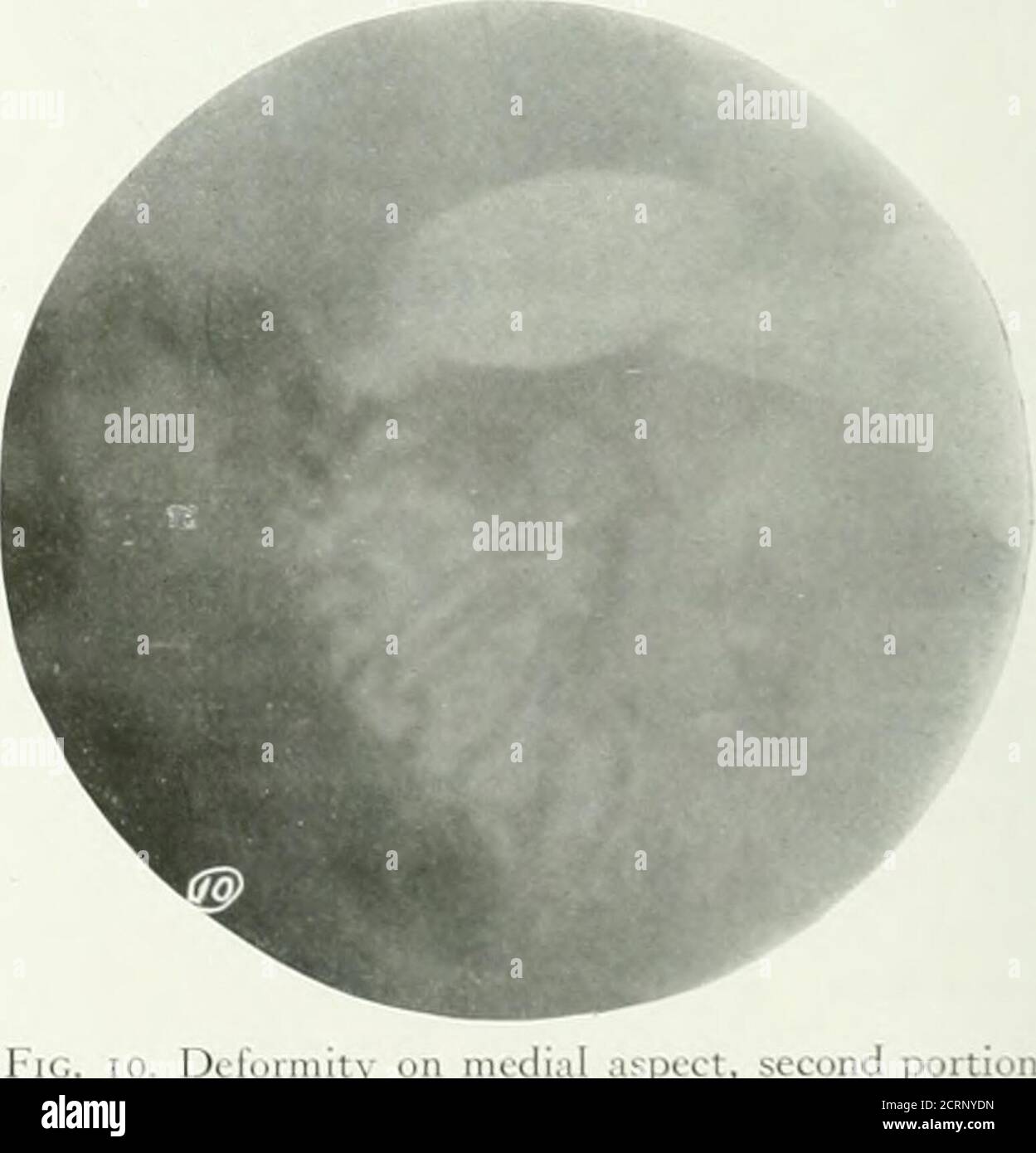 Cardiac sphincter hi-res stock photography and images - Alamy