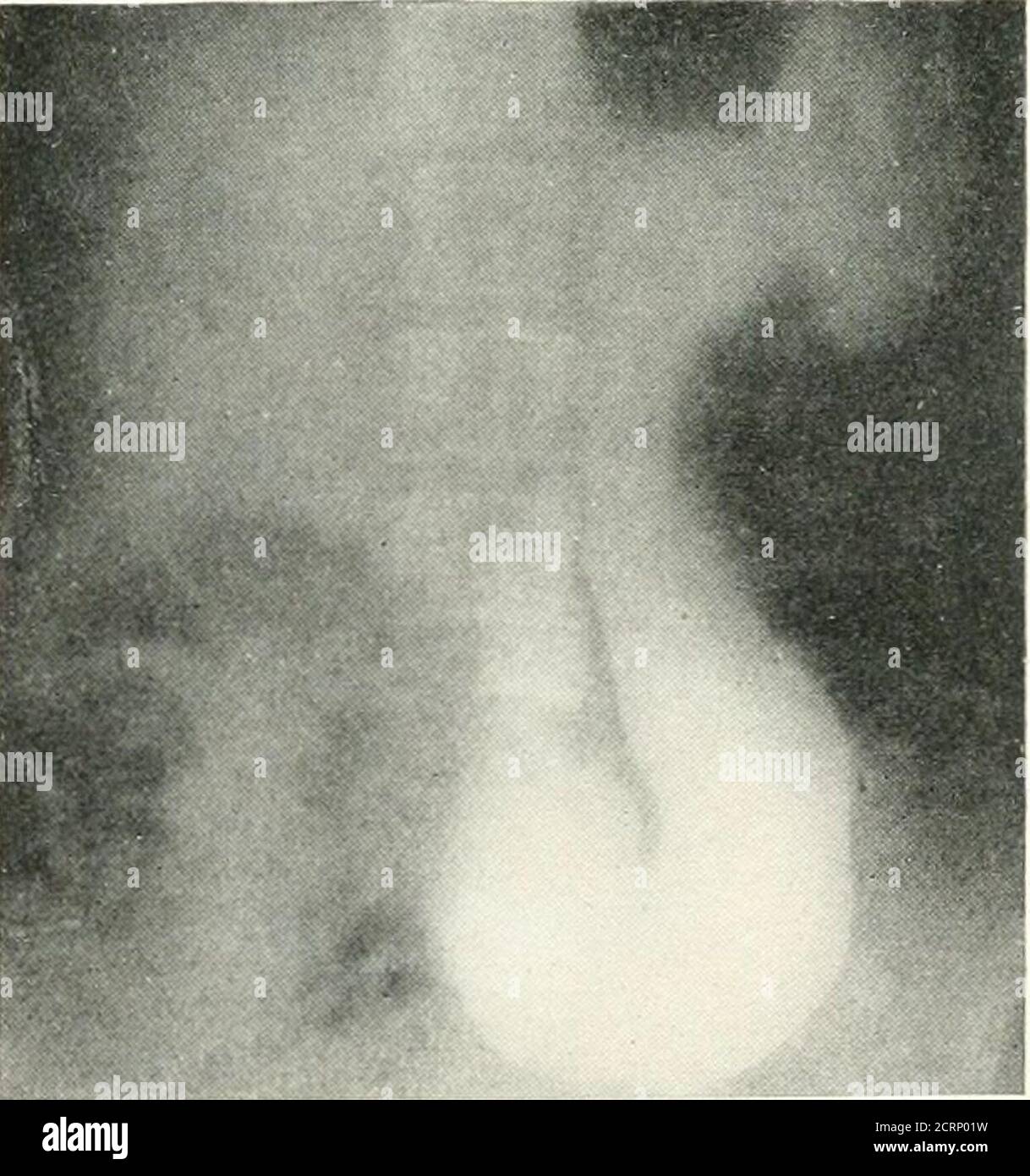 Radiographical hi-res stock photography and images - Alamy