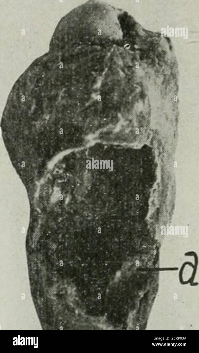 . The American journal of roentgenology, radium therapy and nuclear ...