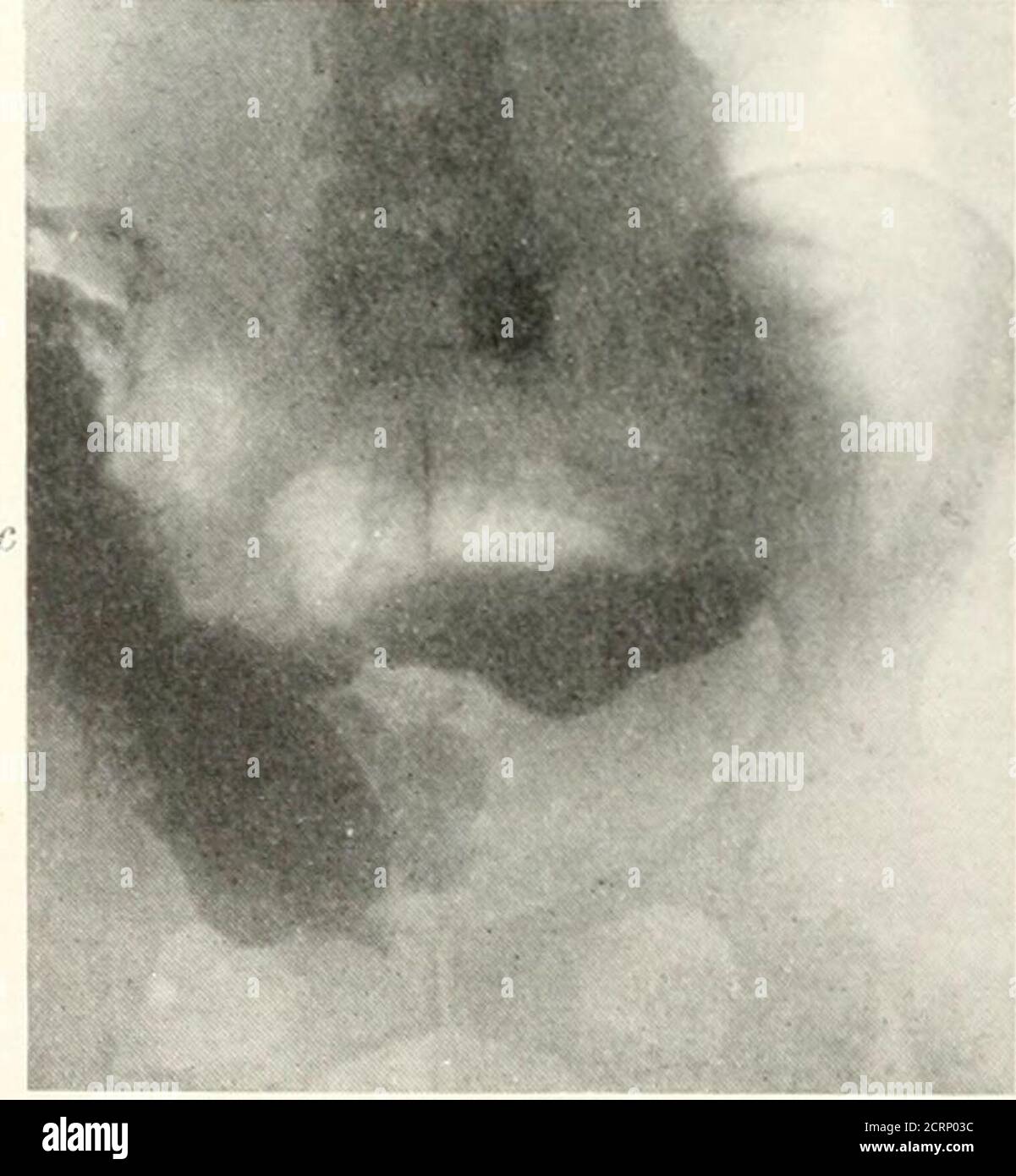 . Radiography, x-ray therapeutics and radium therapy Stock Photo - Alamy