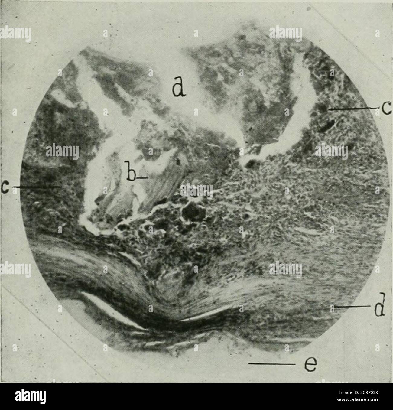 . The American journal of roentgenology, radium therapy and nuclear ...