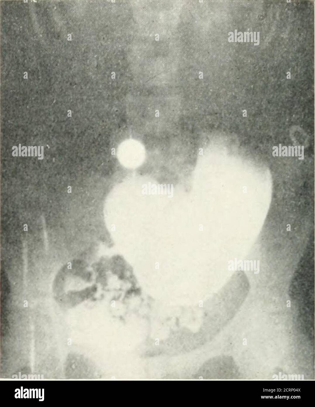 . Radiography, x-ray therapeutics and radium therapy Stock Photo - Alamy