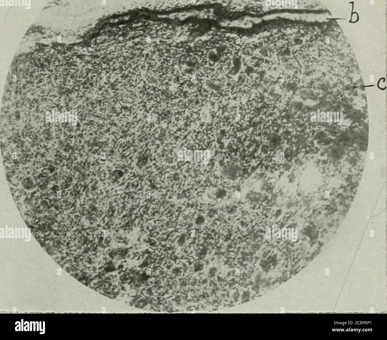 Chondromas hi-res stock photography and images - Alamy