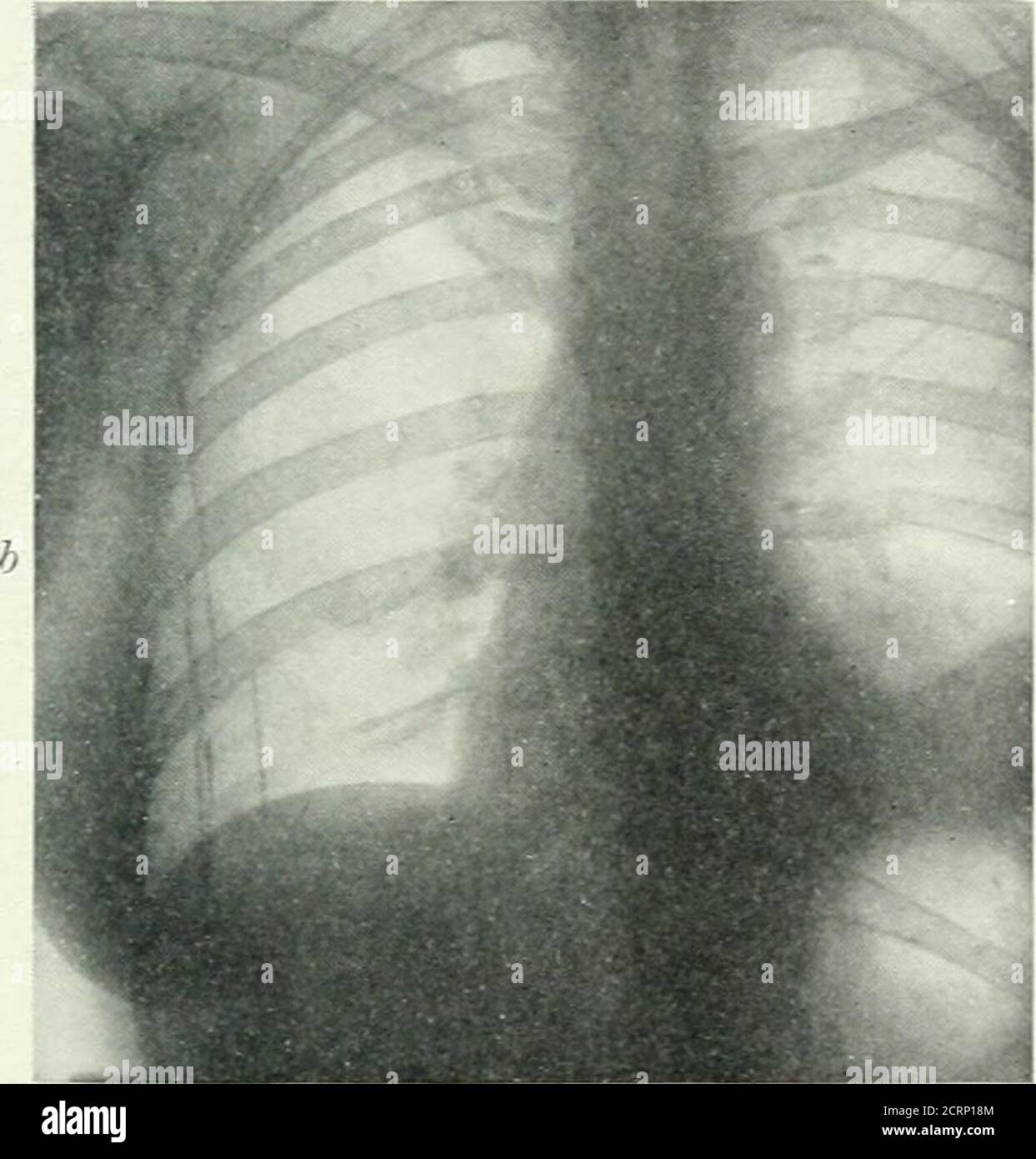 . Radiography, x-ray therapeutics and radium therapy . ^ 1 Stock Photo ...
