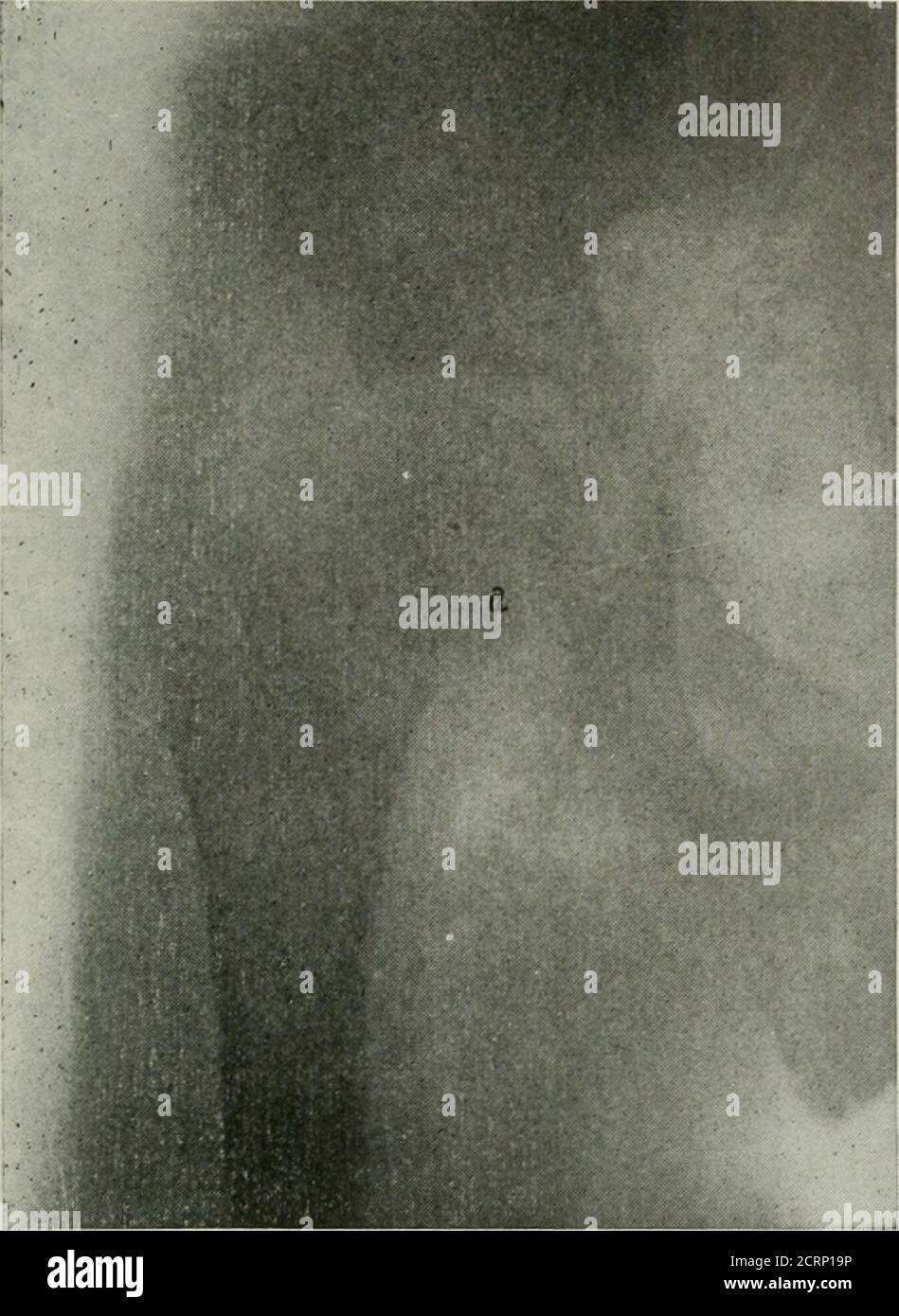 . The American journal of roentgenology, radium therapy and nuclear ...