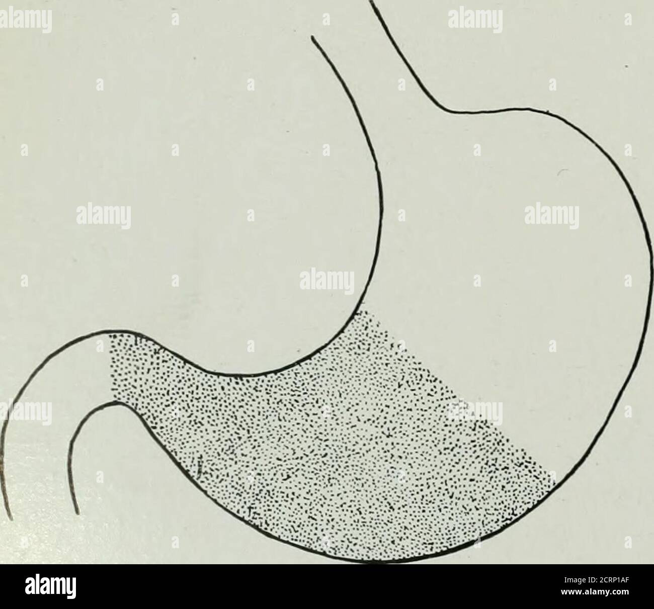 . The American journal of roentgenology, radium therapy and nuclear ...